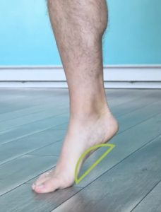 Rigid Flat Feet or Flexible Flat Feet... What's the difference ...