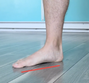 Rigid Flat Feet or Flexible Flat Feet... What's the difference ...